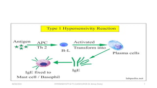Hypersensitivity and its classification .pptx