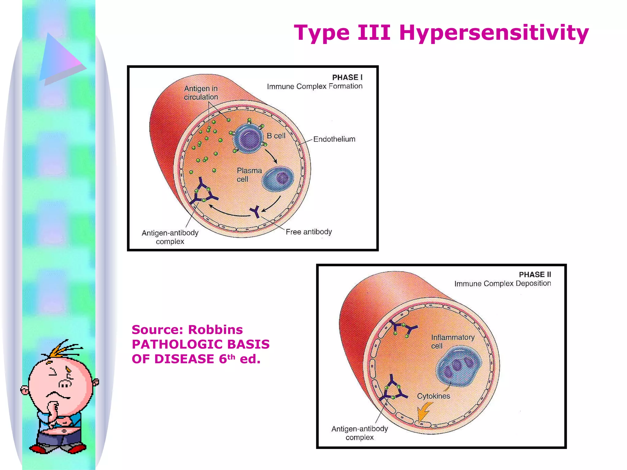 Hypersensitivity | PPT