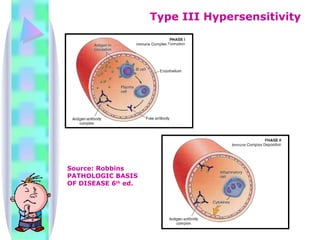 Hypersensitivity | PPT