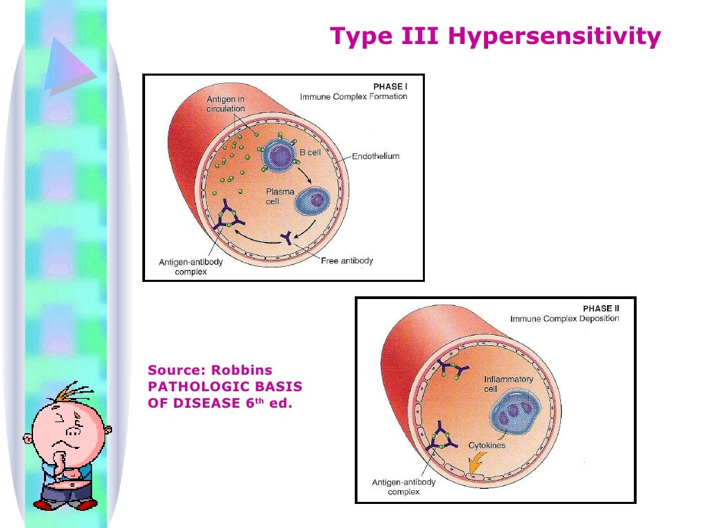 Hypersensitivity hypersensitivity