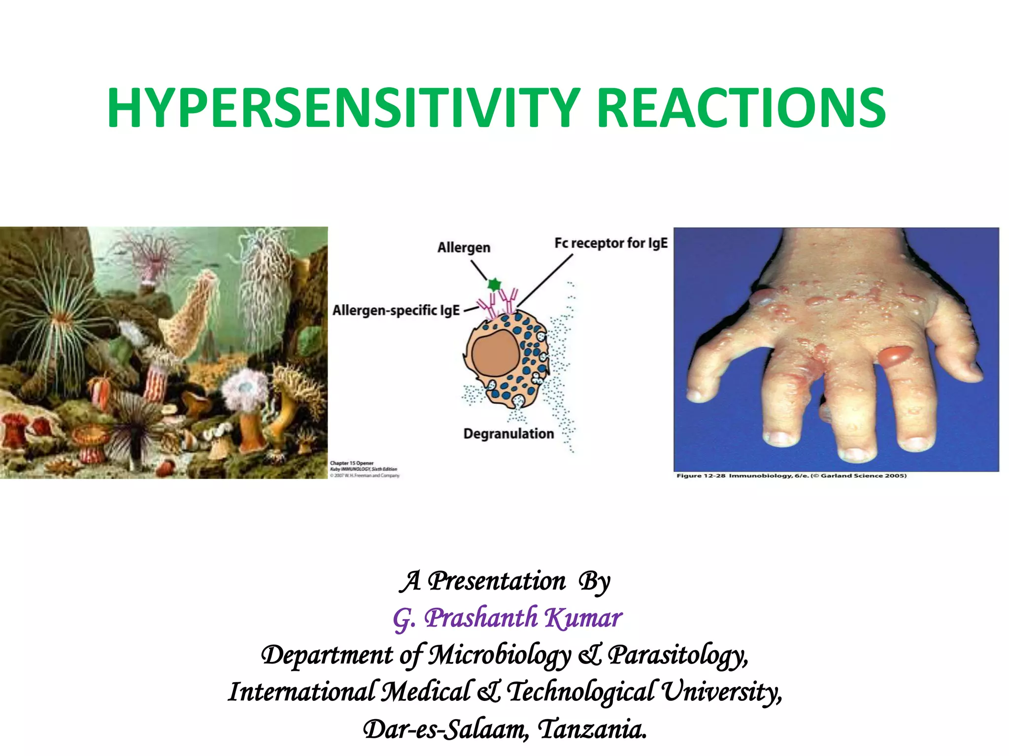 Hypersensitivity | PPTX