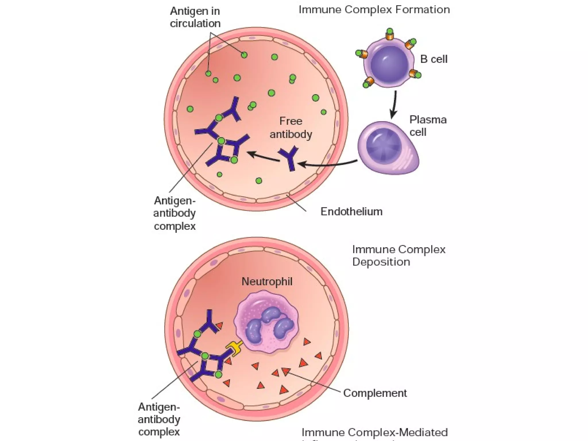 Hypersensitivity reaction pathology microbiology immunity | PPT