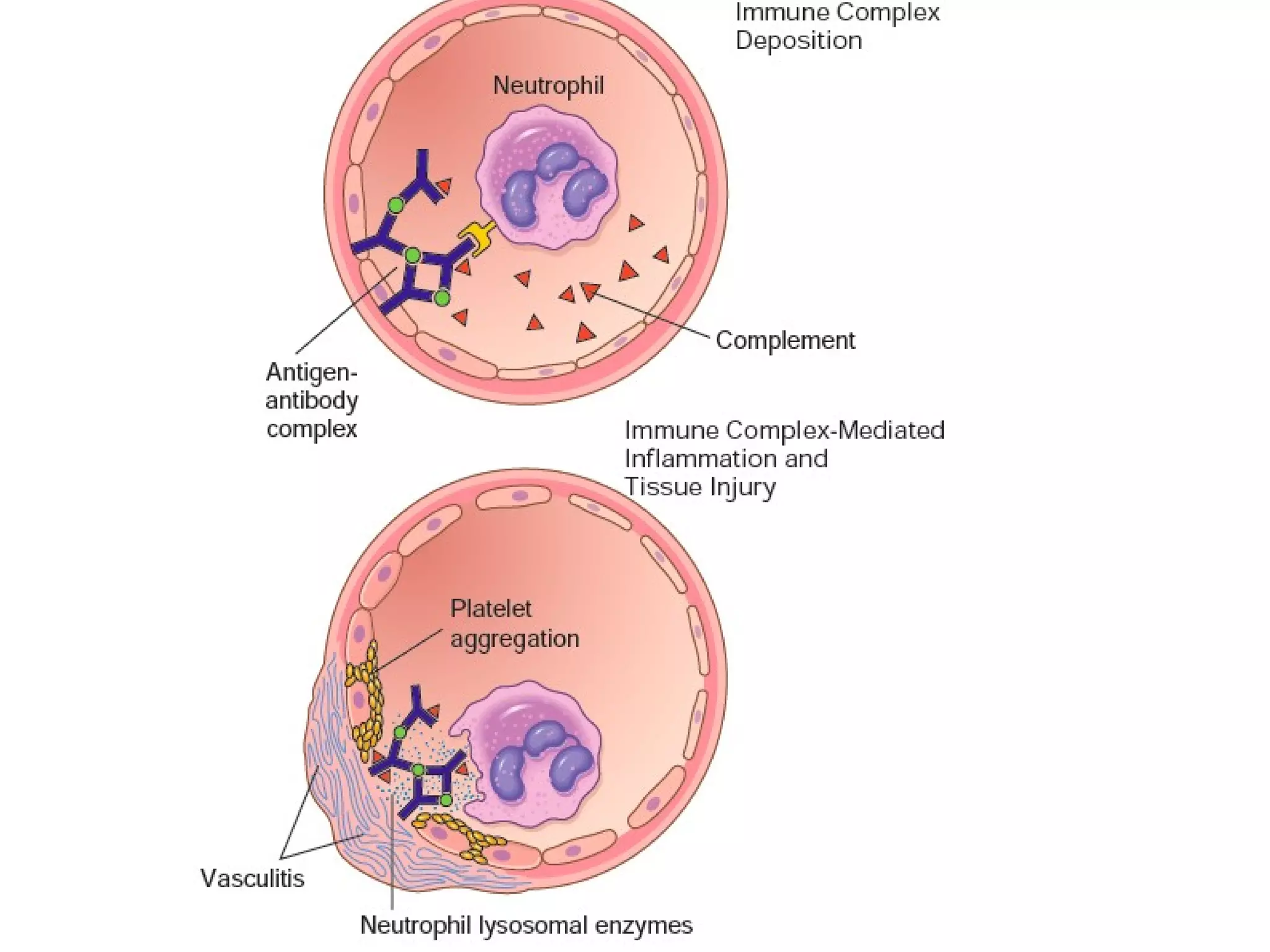 Hypersensitivity reaction pathology microbiology immunity | PPT