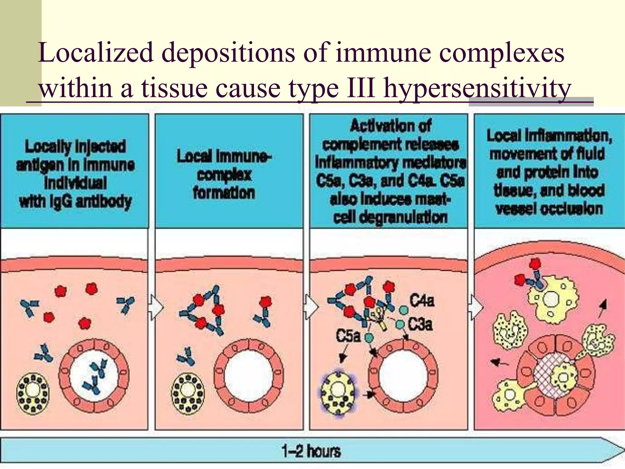 Hypersensitivity | PPT