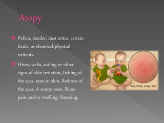 Hypersensitivity | PPTX