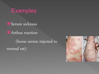 Hypersensitivity | PPTX