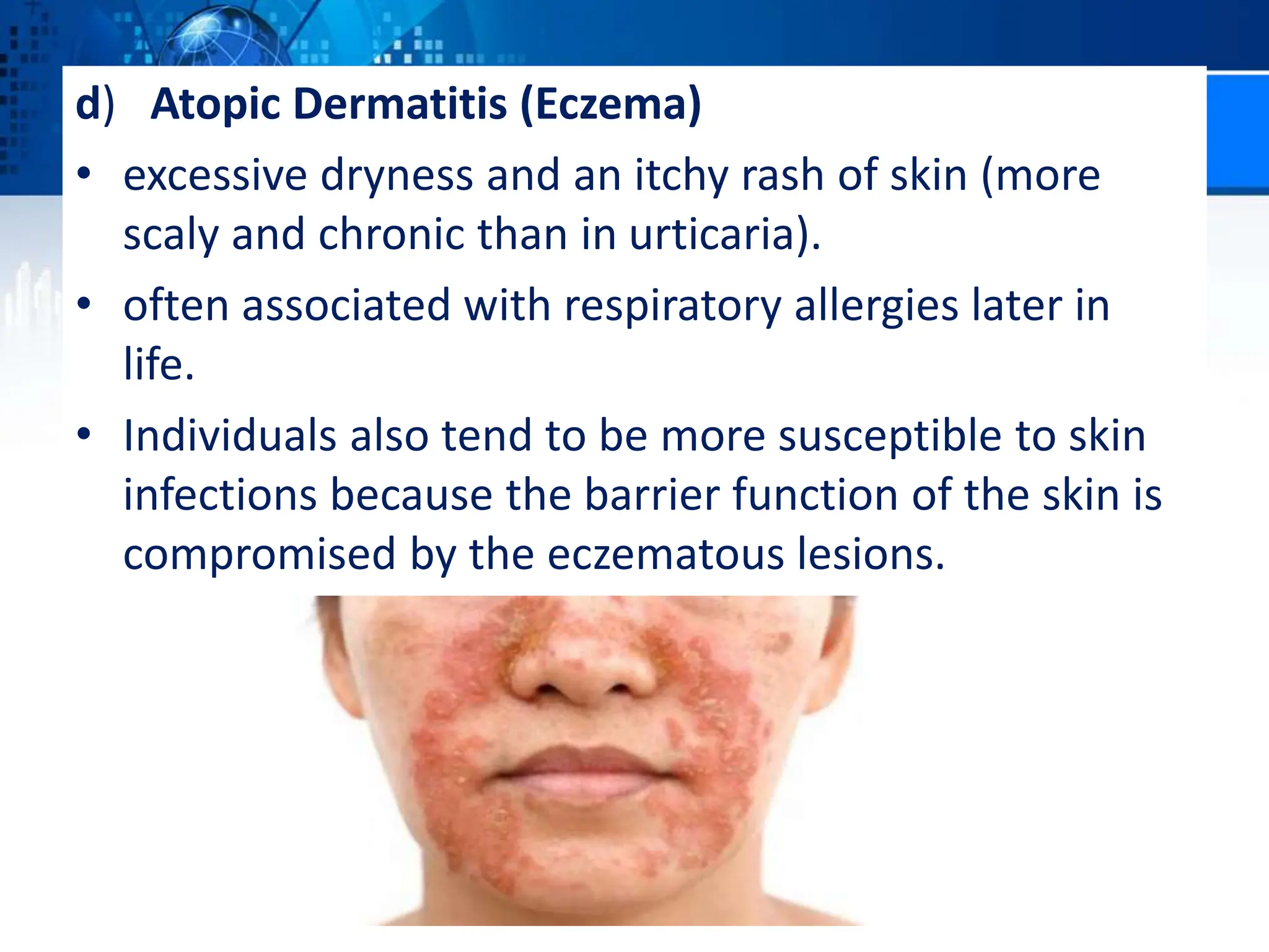 HYPERSENSITIVITY and Its Types and related reaction with examples | PPTX