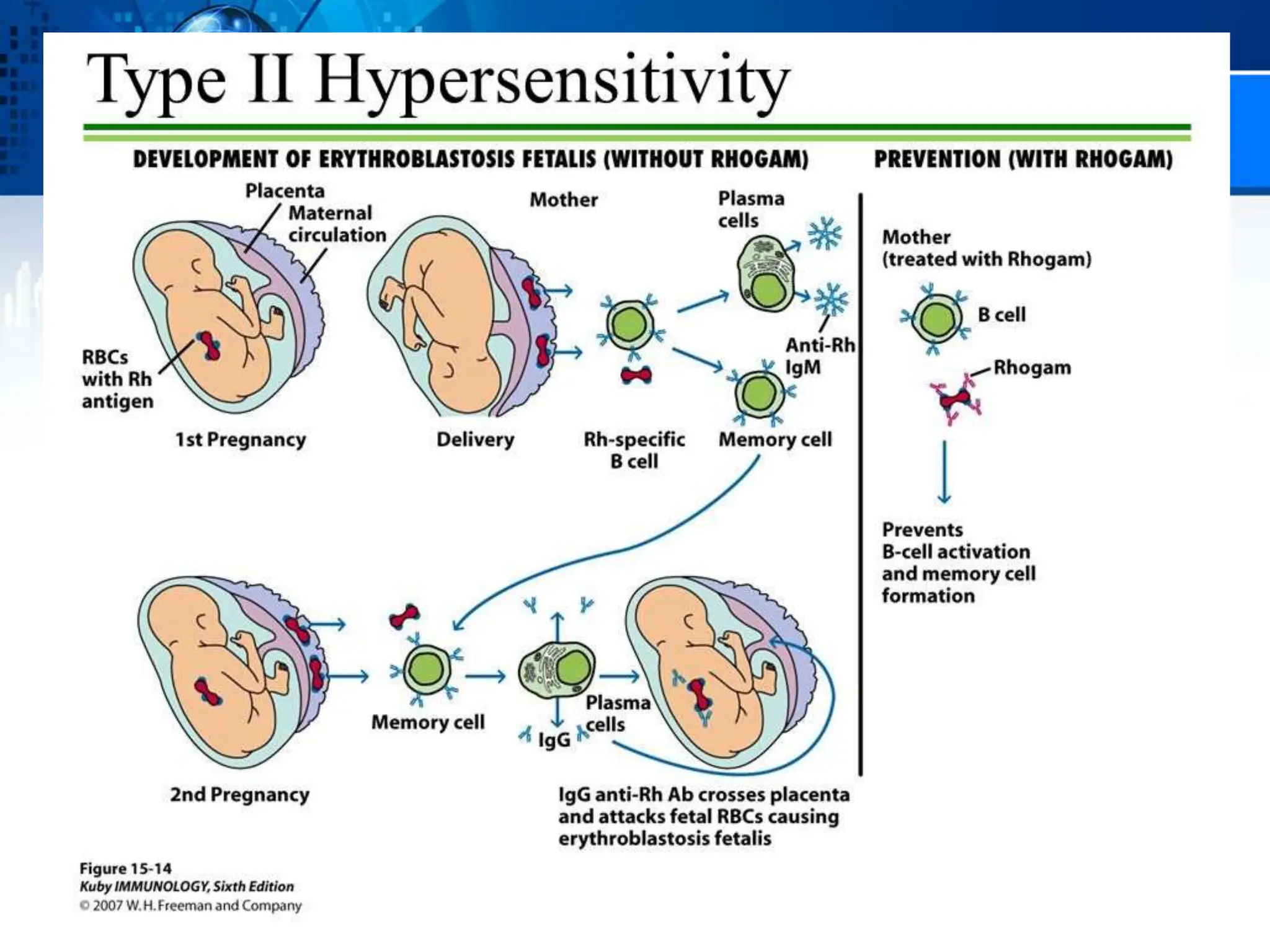 HYPERSENSITIVITY and Its Types and related reaction with examples | PPTX | Lung and Respiratory ...