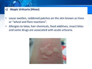 HYPERSENSITIVITY and Its Types and related reaction with examples | PPTX