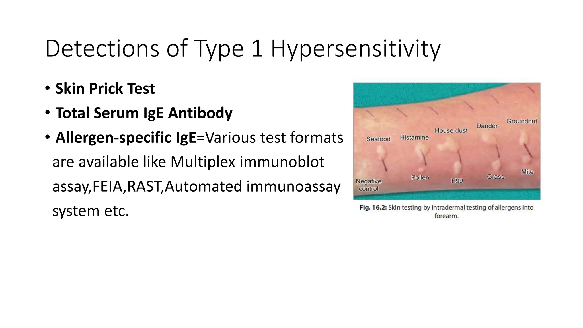 Hypersensitivity type 1 reaction with classification .pptx