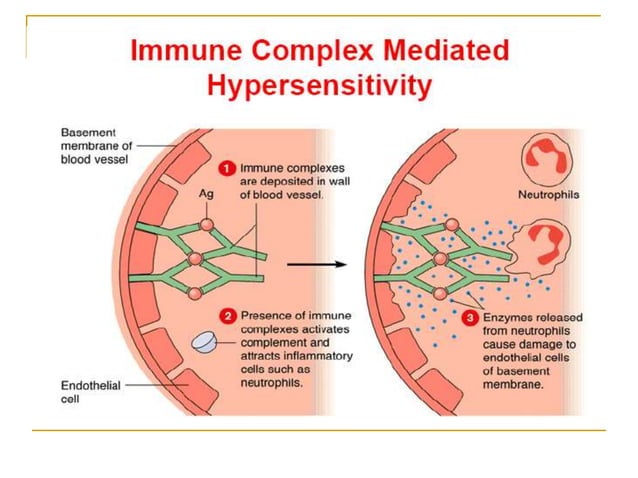 Hypersensitivity and its causes and effects.ppt