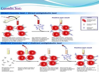 Hypersensitivity I,II,III & IV, the causative agents, the mechanism | PDF