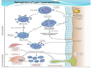 Types of HYPERSENSITIVITY and their description.ppt