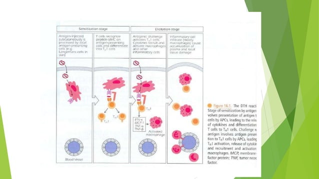 Hypersensitivity- types of hypersensitivity.pptx