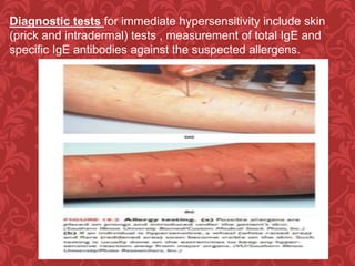 Hypersensitivity and its types ( type 1 anaphylaxis, type 2, Type 3 ...