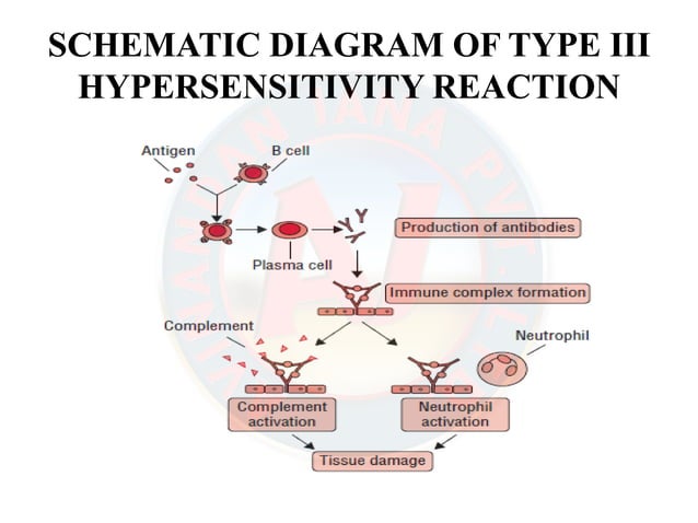Hypersensitivity (Allergy) - Drug allergy, Contact dermatitis, Allergic ...