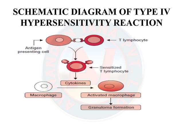 Hypersensitivity (Allergy) - Drug allergy, Contact dermatitis, Allergic ...