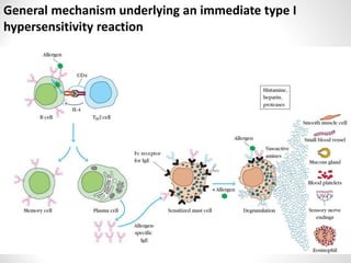 HYPERSENSITIVITY | PPTX