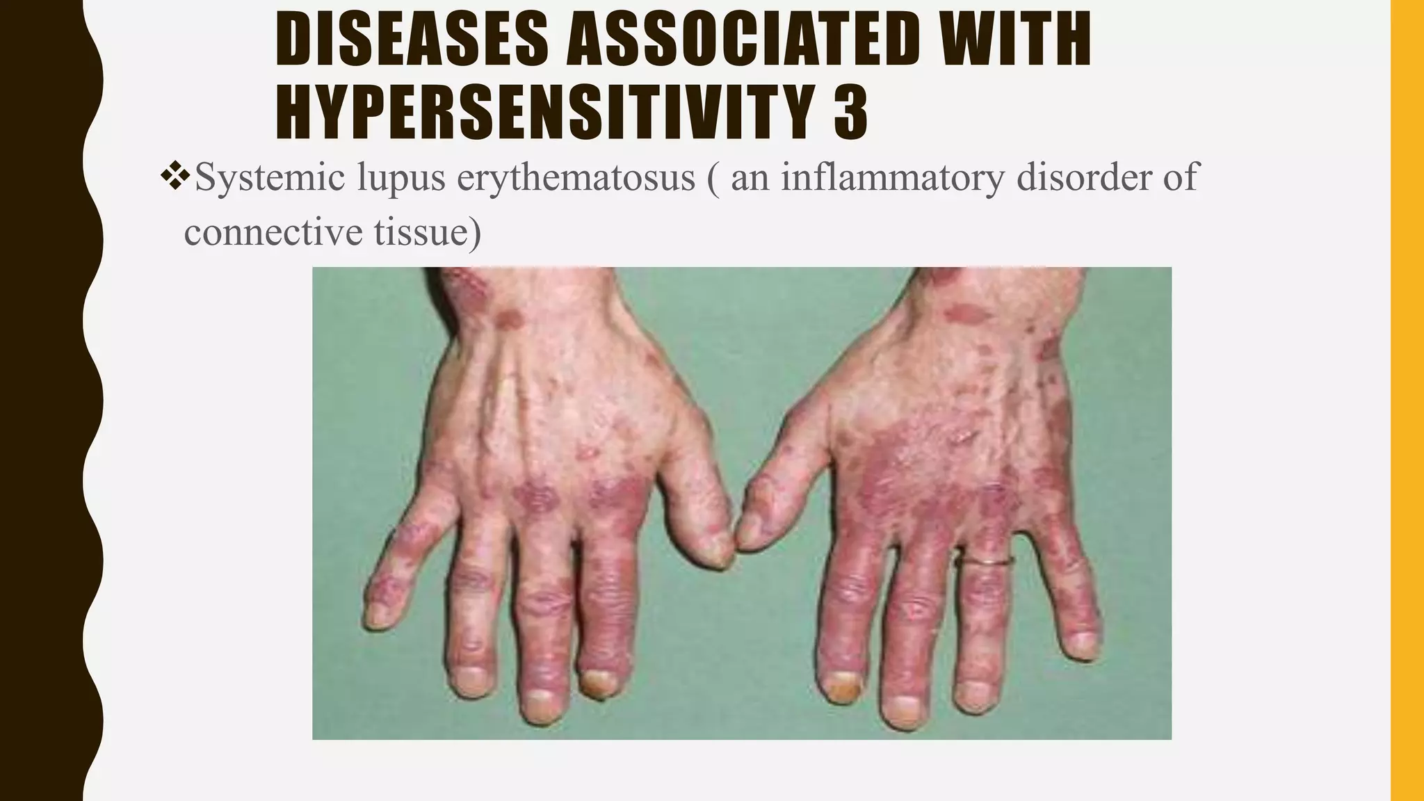 Hypersensitivity 3 | PPTX