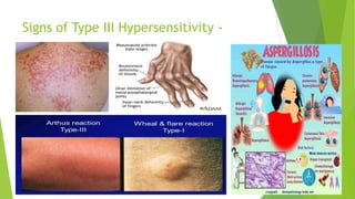 Hypersensitivity and its types.pptx