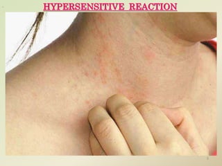Hypersensitivity or Allergic Reactions | PPTX