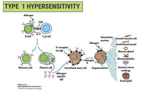 Hypersensitivity:Types, Mechanism,Example | PDF