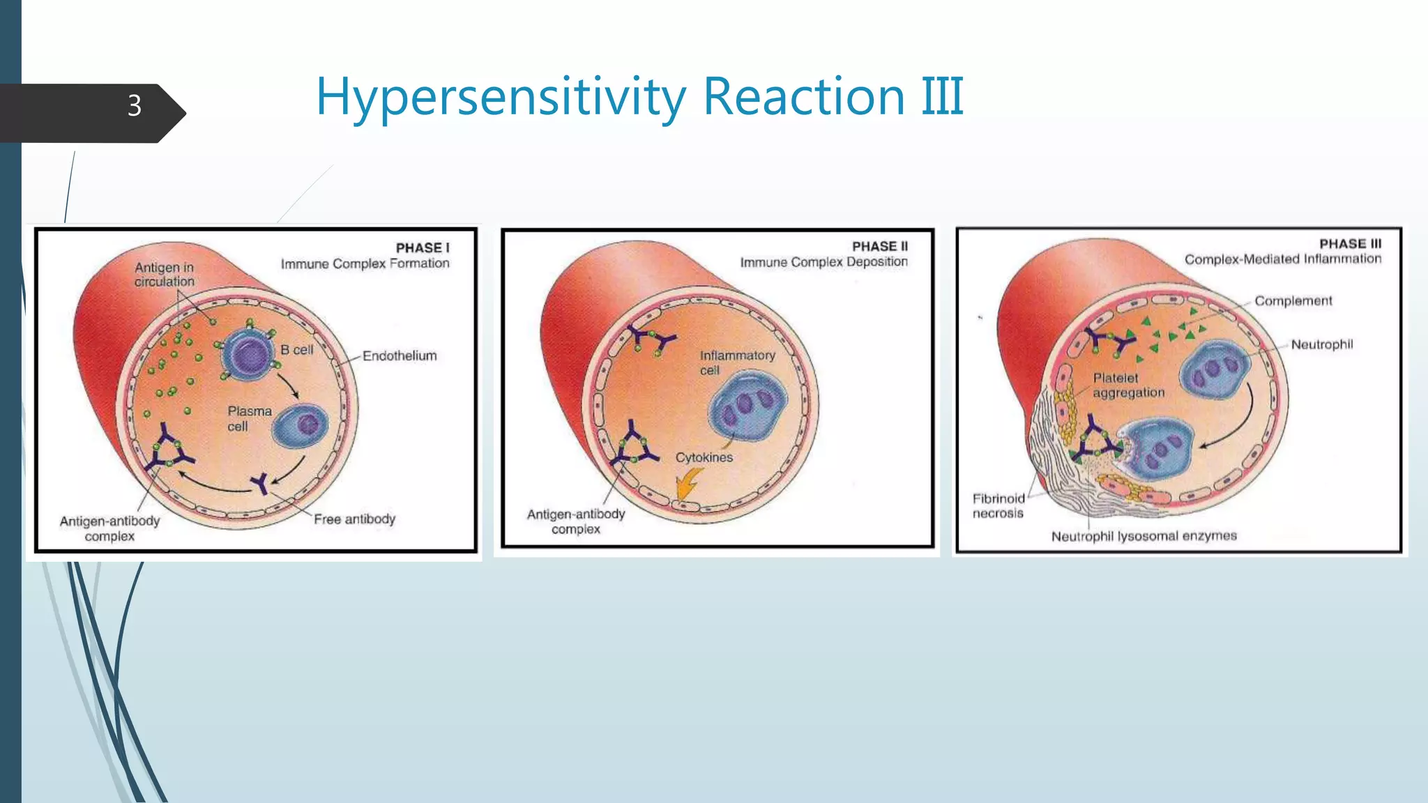 Hypersensitivity Reactions | PPTX