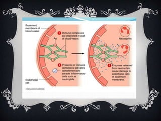 Hypersensitivity reactions of a drug | PPTX