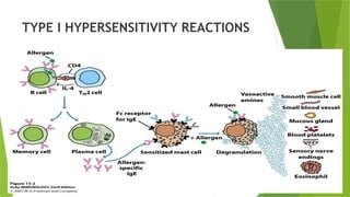 HYPERSENSITIVITY-TYPE 1 Mechanism .pptx