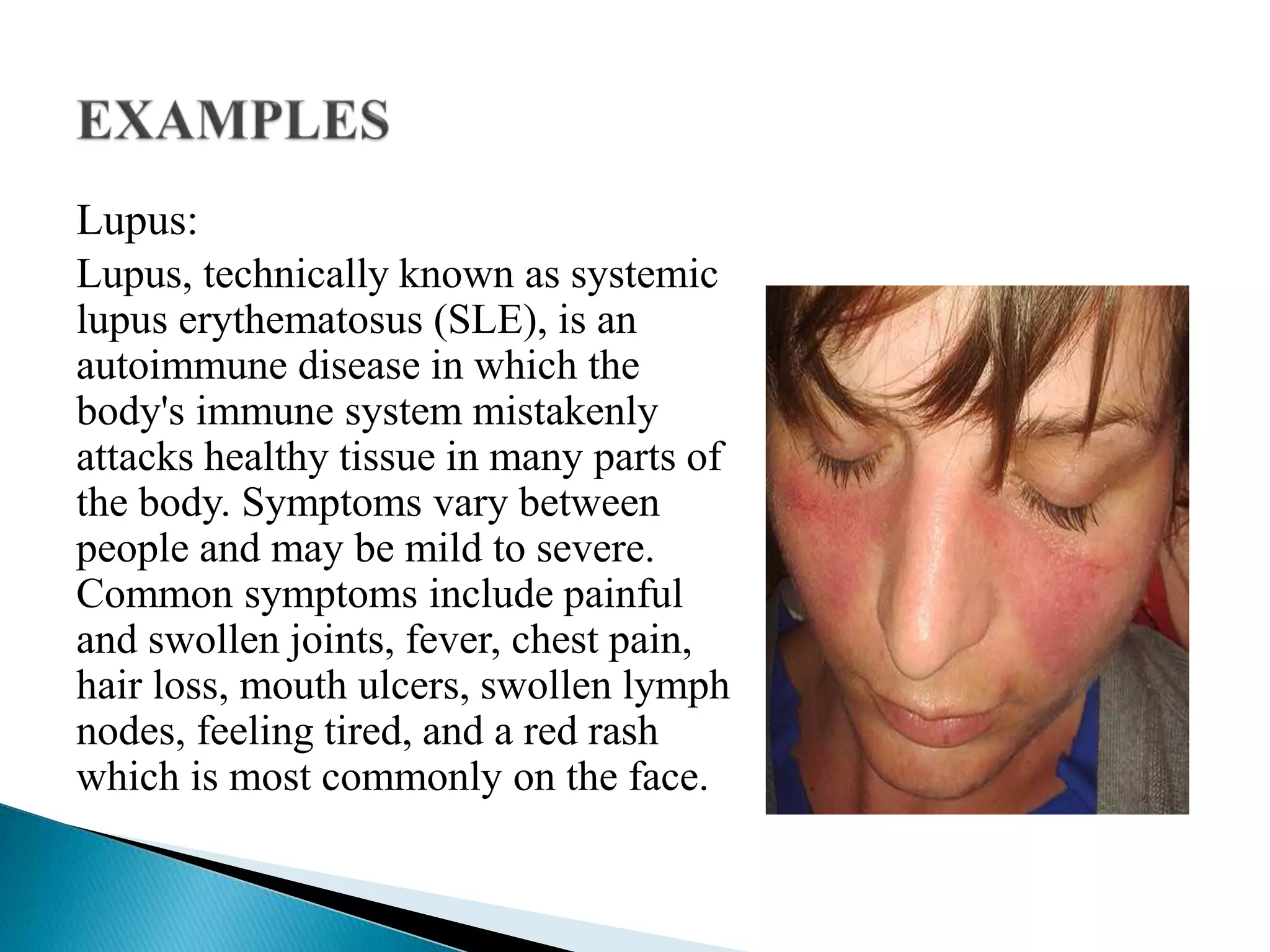 Hypersensitivity type 3 | PPT