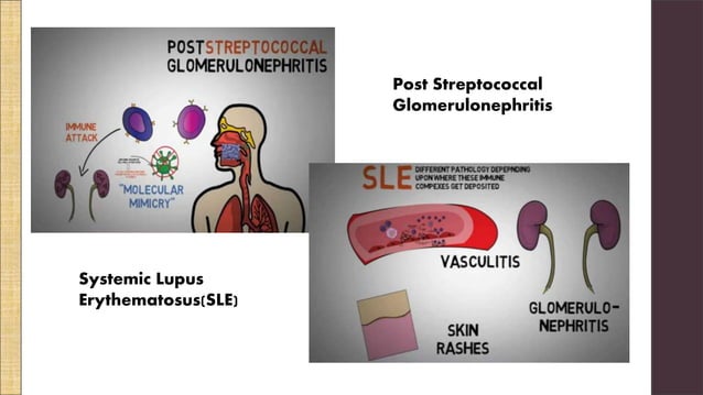 HYPERSENSITIVITY TYPE III.pptx | Blood Disorders | Diseases and Conditions