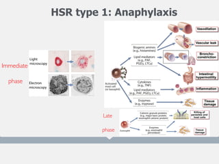 Hypersensitivity types | PDF
