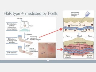 Hypersensitivity types | PDF