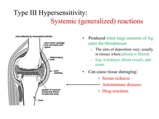 Hypersenstivity.ppt