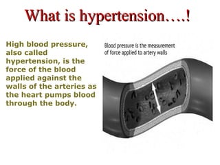 Hypertension | PPT