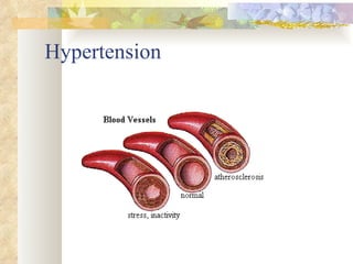 Hypertension | PPT