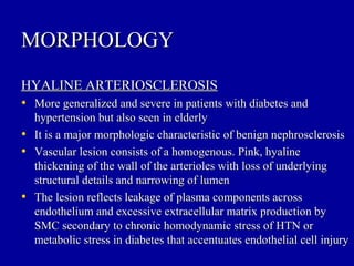 Hypertension | PPT