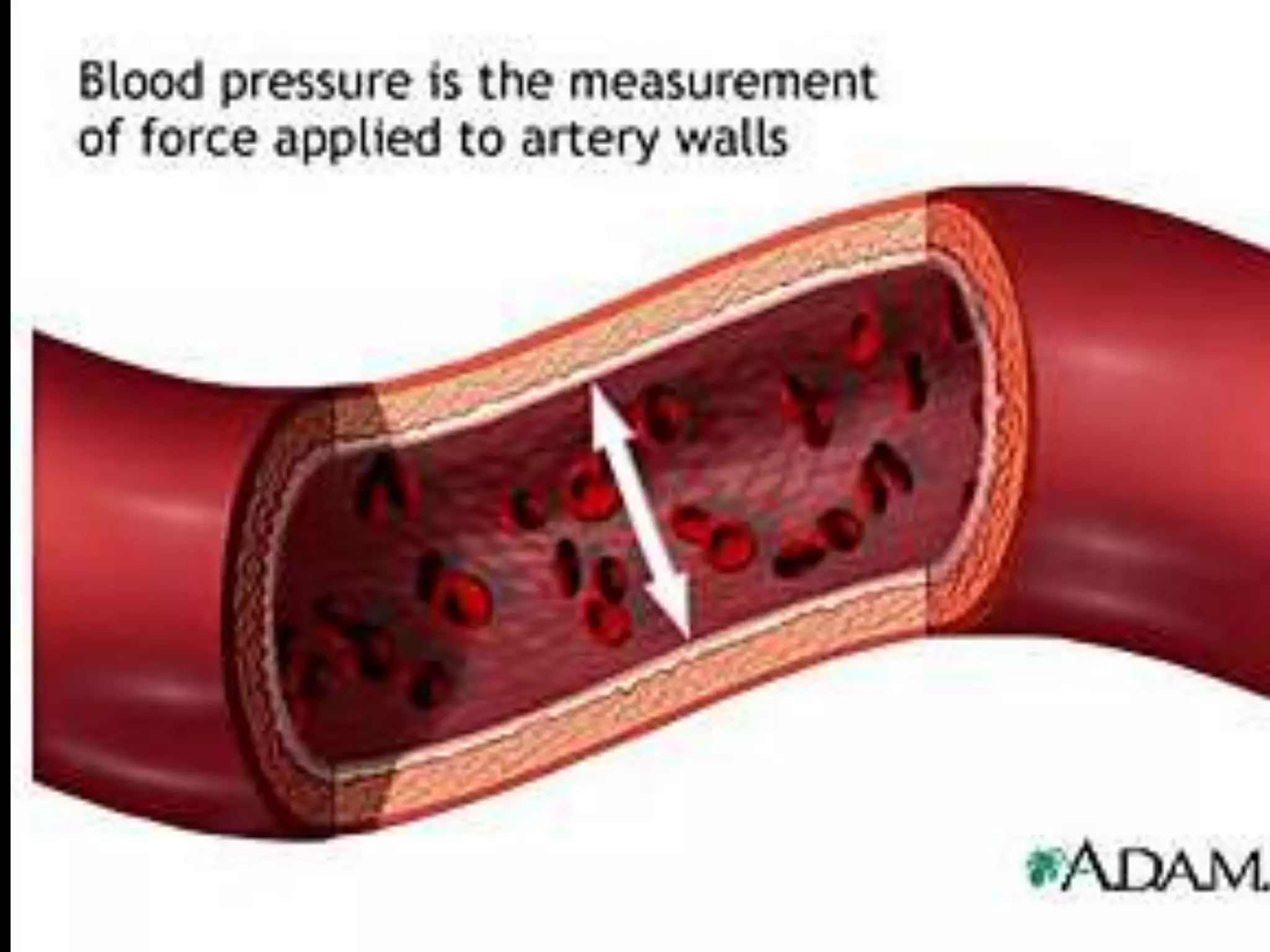 Hypertension, its causes, types and management | PPTX