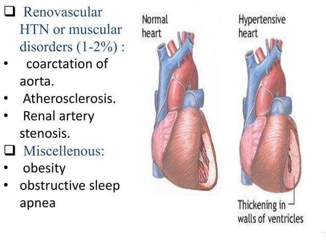 Hypertension, its causes, types and management | PPTX
