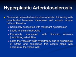 Hyperplastic Arteriosclerosis