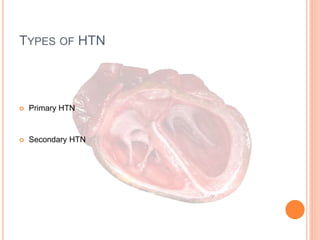 Hypertension | PPTX