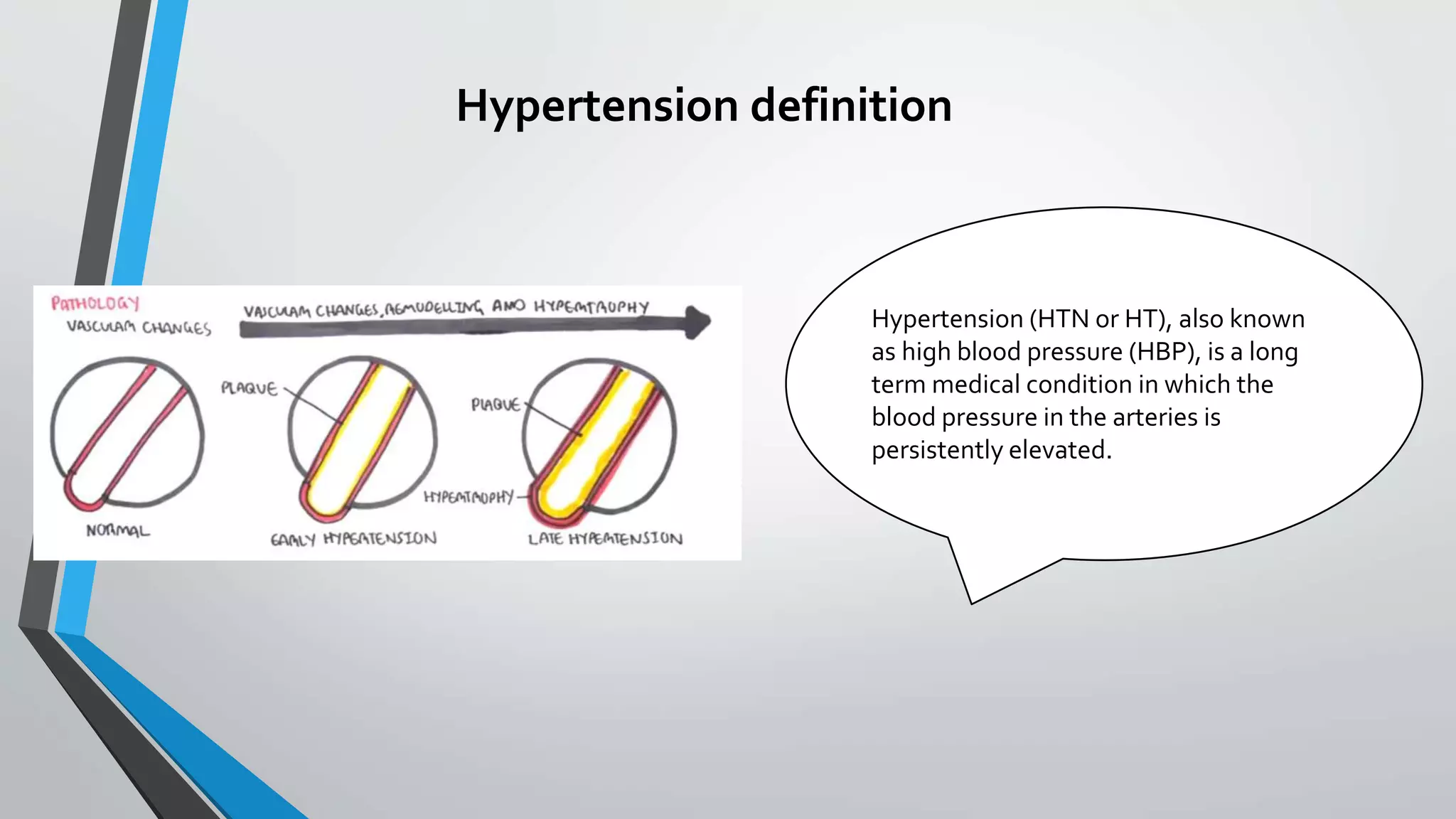 Hypertension | PPTX