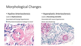 Hypertension | PPTX | Endocrine and Metabolic Diseases | Diseases and ...