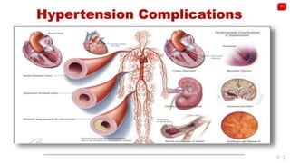 Hypertension slideshare | PPT