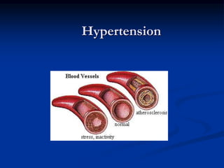 Hypertension.ppt | Heart and Cardiovascular Diseases | Diseases and ...