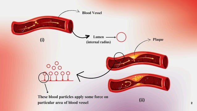 Hypertension Overview: From Etiology to Clinical Features | PPT