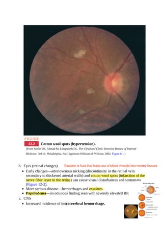 Hypertension HTN (cardiovascular system) | PDF