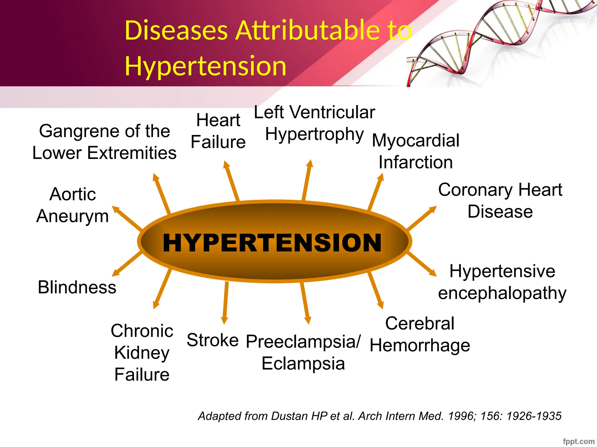 the hypertension complete explained.pptx