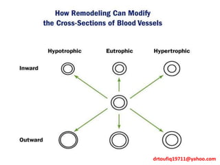 Hypertension - definitions, etiology and mechanisms | PPSX