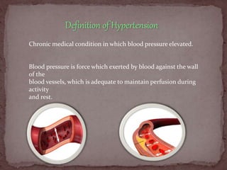 Hypertension.pptx